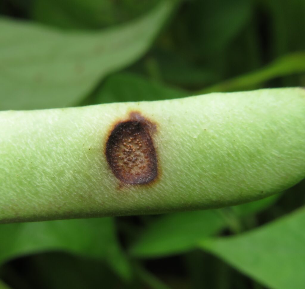 Anthracnose – Dry Bean Agronomy